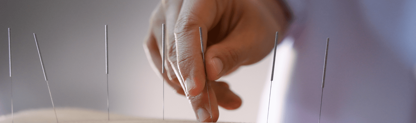 Acupuncture Doctors In Mumbai | Acupuncture Therapy In Mumbai ...