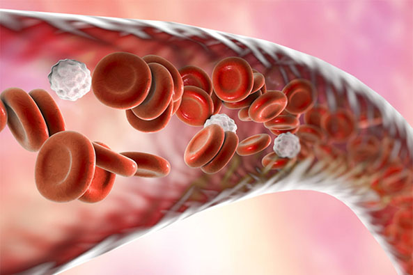 Hemato Oncology (Blood Cancers): Dr. Shilpa Gupta, Consultant ...